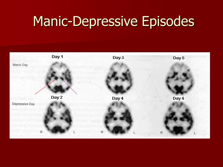 PPT - Depression, Schizophrenia, and Bipolar Disorder PowerPoint ...