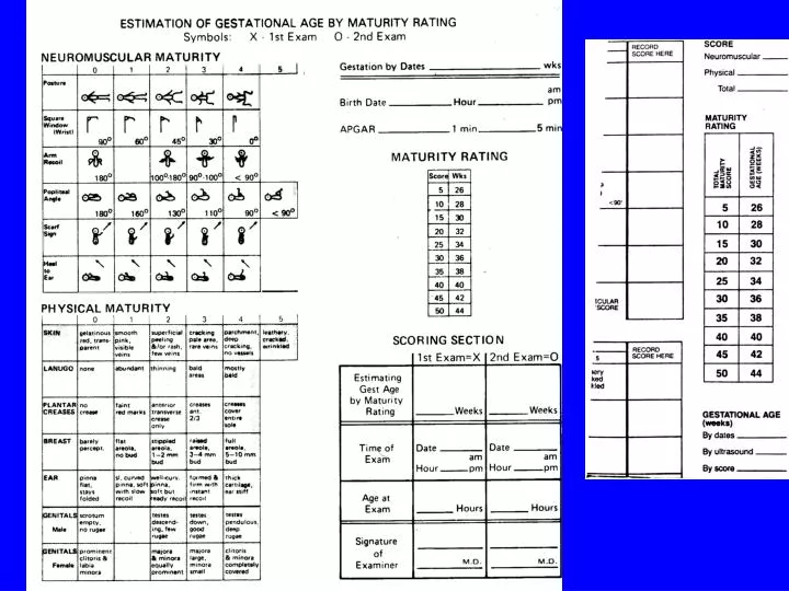 PPT - Same gestational age SGA AGA LGA PowerPoint Presentation, free ...