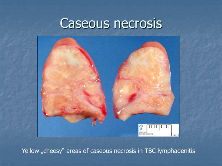 PPT - Cell injury:necrosis, apoptosis. Adaptations:atrophy, hypertrophy ...