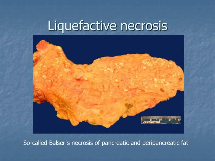 PPT - Cell injury:necrosis, apoptosis. Adaptations:atrophy, hypertrophy ...