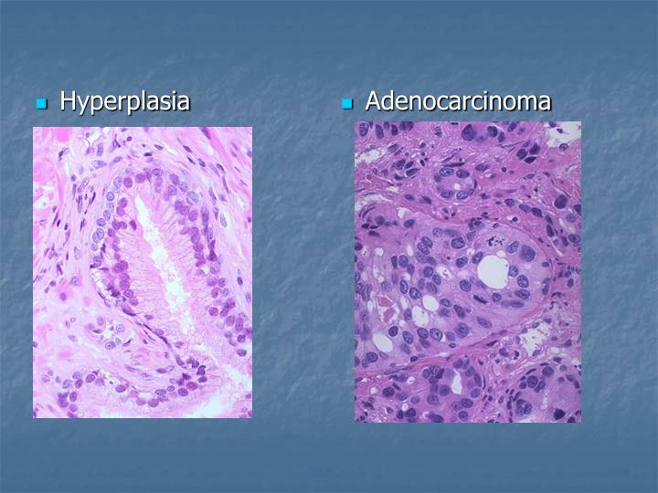 PPT - Cell injury:necrosis, apoptosis. Adaptations:atrophy, hypertrophy ...