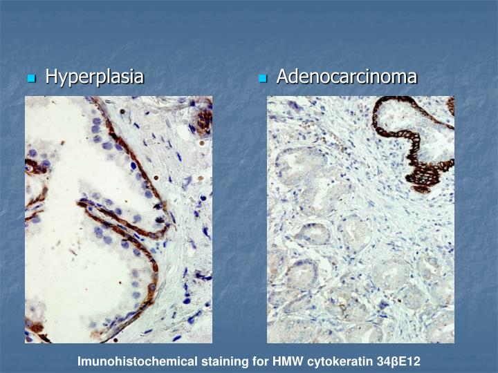 PPT - Cell injury:necrosis, apoptosis. Adaptations:atrophy, hypertrophy ...