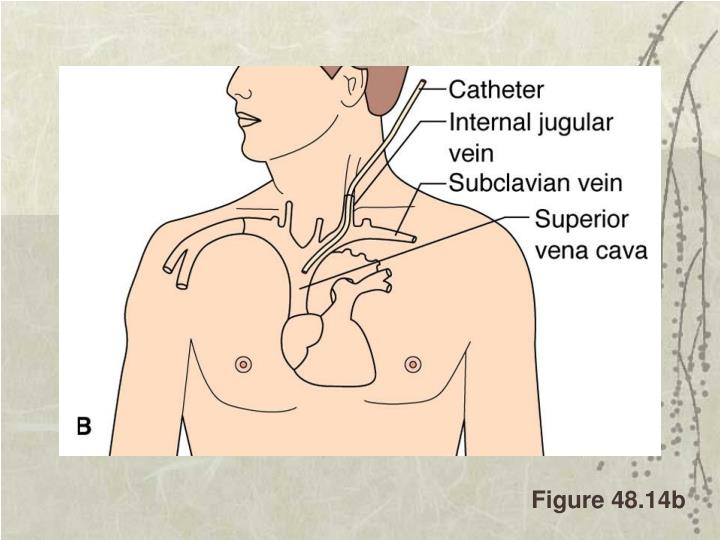 PPT - IV Therapy PowerPoint Presentation - ID:760166