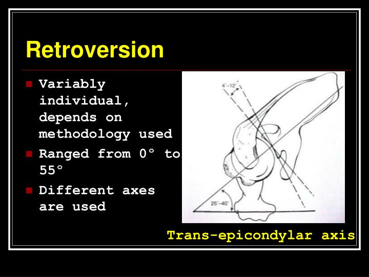 PPT - What is in Shoulder Arthroplasty ? PowerPoint Presentation - ID ...