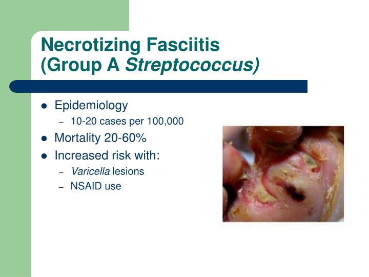 PPT - Soft Tissue Infections PowerPoint Presentation - ID:760835