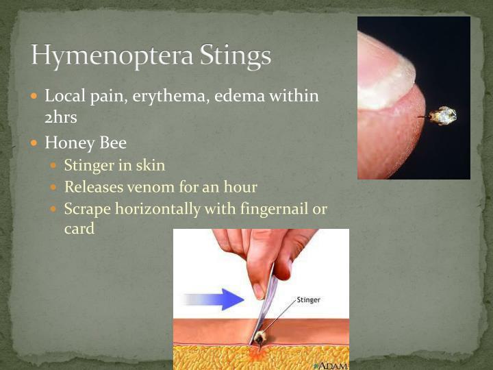 PPT - Bites and Stings PowerPoint Presentation - ID:764053