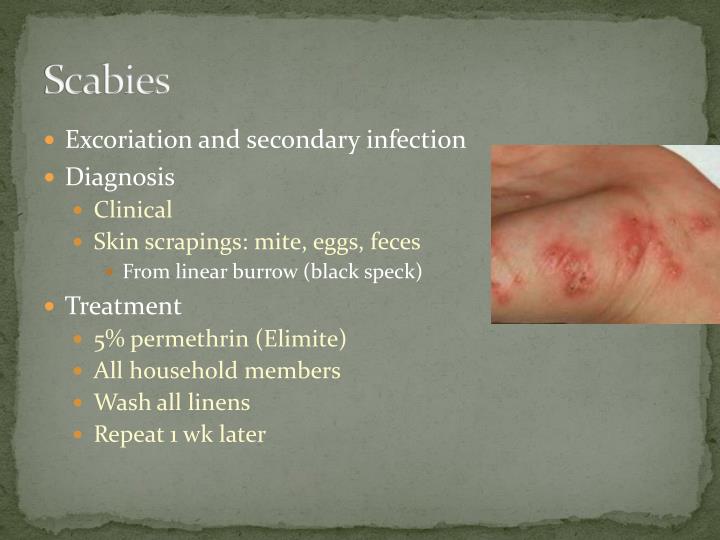 PPT - Bites and Stings PowerPoint Presentation - ID:764053