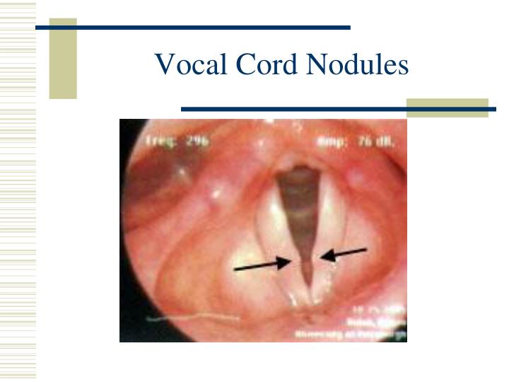 PPT - Nasopharyngolaryngoscopy for Family Physicians PowerPoint ...