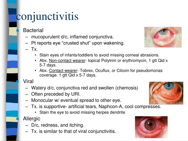 PPT - Ocular emergencies PowerPoint Presentation - ID:764166