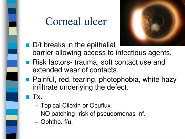 PPT - Ocular emergencies PowerPoint Presentation - ID:764166