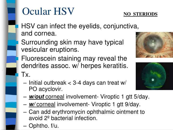 PPT - Ocular emergencies PowerPoint Presentation - ID:764166