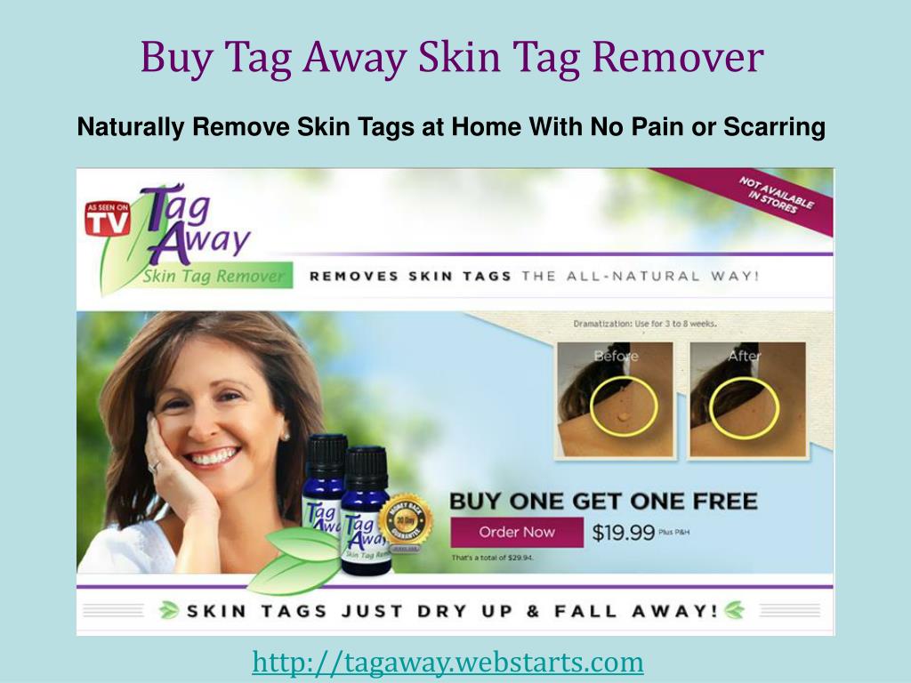 PPT - Buy Tag Away and Go With Proven Skin Tag Removal Results ...