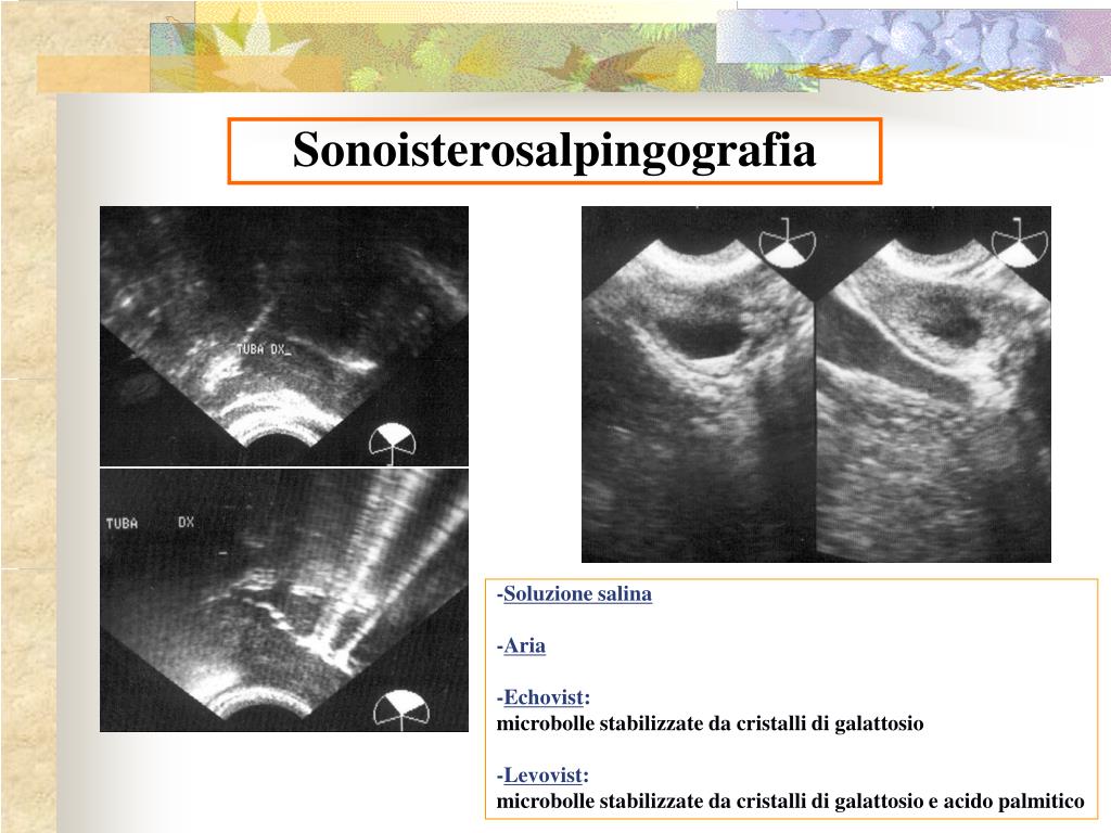 PPT - Incontri del Martedì - Padova, 16 marzo 2010 PowerPoint ...
