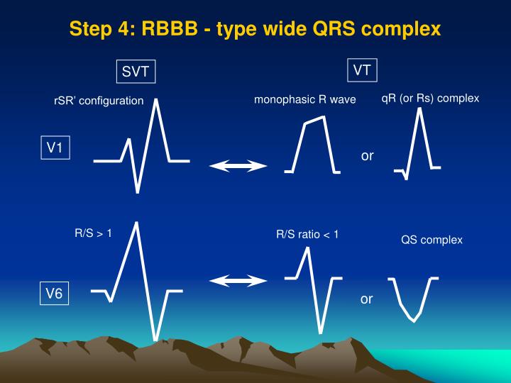 PPT - APPROACH TO WIDE QRS COMPLEX TACHYCARDIA PowerPoint Presentation ...