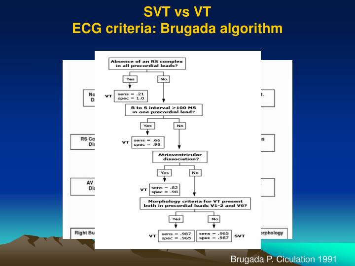 PPT - APPROACH TO WIDE QRS COMPLEX TACHYCARDIA PowerPoint Presentation ...