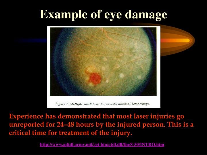 PPT - Laser Safety Seminar PowerPoint Presentation - ID:772271