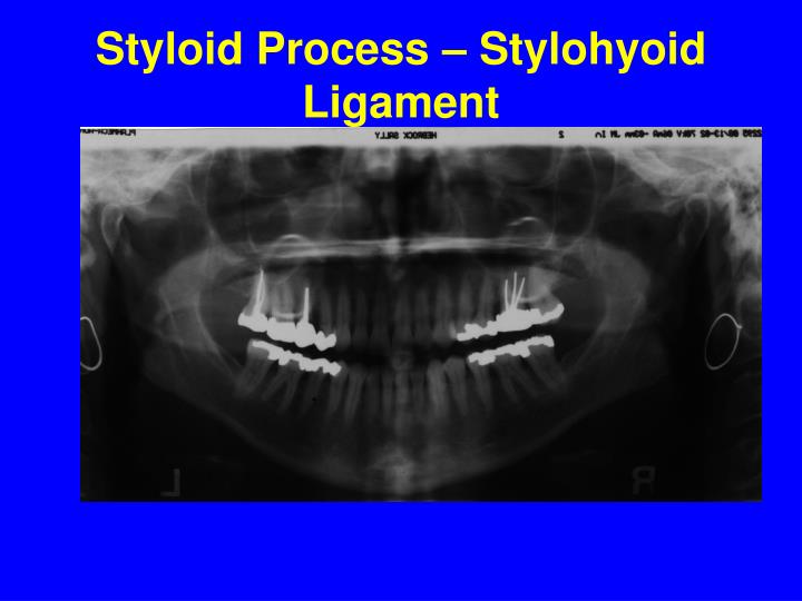 PPT - RADIOGRAPHIC INTERPRETATION PowerPoint Presentation - ID:774163