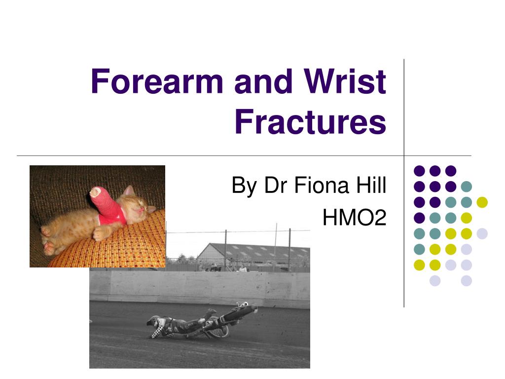 Ppt Forearm And Wrist Fractures Powerpoint Presentation Free
