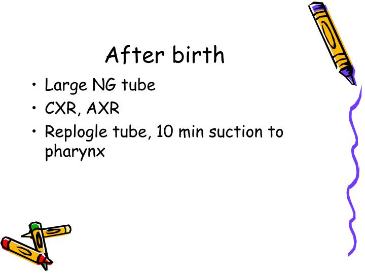 PPT - OESOPHAGEAL ATRESIA PowerPoint Presentation - ID:789902