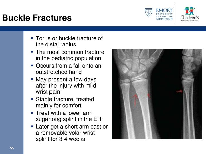 PPT - Pediatric Orthopedic Emergencies Tracy Merrill MD PowerPoint ...