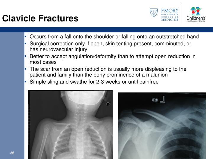 PPT - Pediatric Orthopedic Emergencies Tracy Merrill MD PowerPoint ...