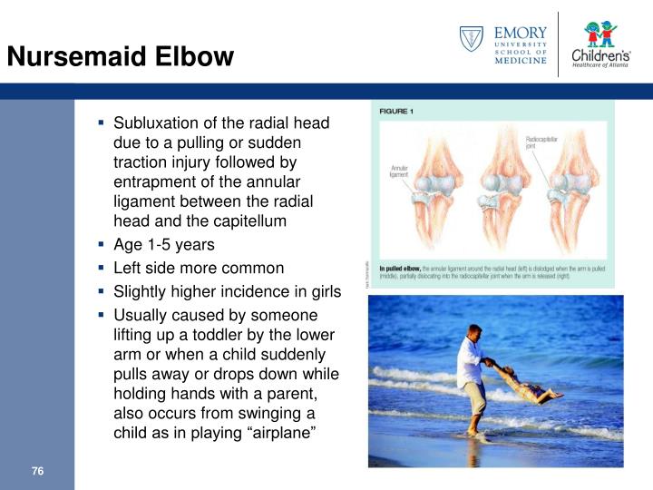PPT - Pediatric Orthopedic Emergencies Tracy Merrill MD PowerPoint ...