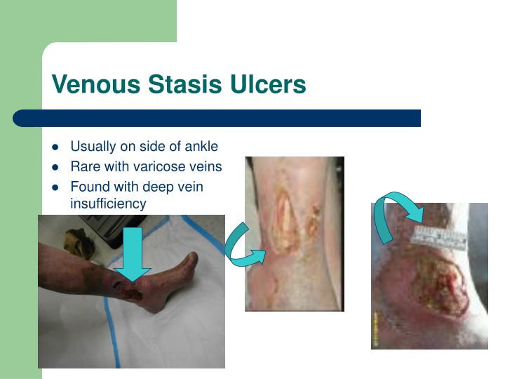 PPT - Nursing Care of The Older Adult PowerPoint Presentation - ID:793434