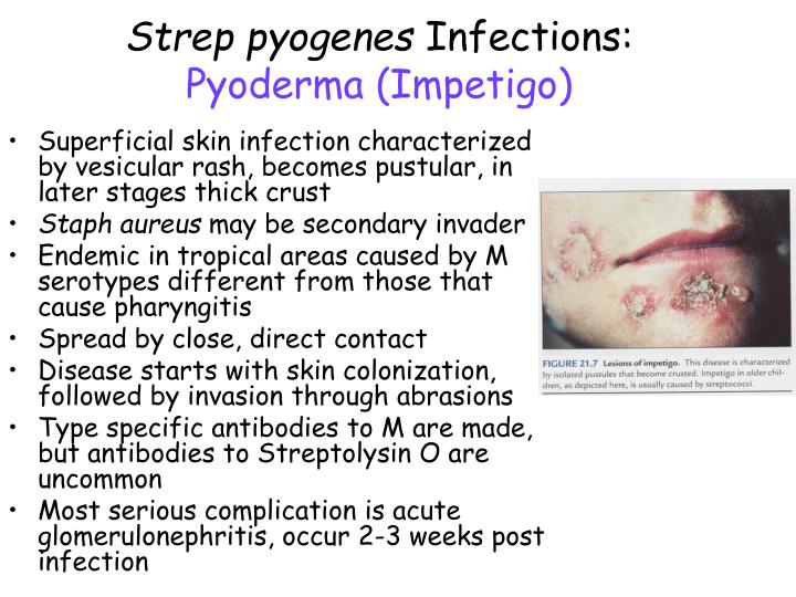 Ppt Streptococcaceae Powerpoint Presentation Id795114