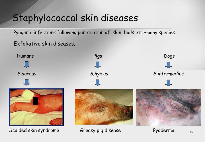 PPT - Staphylococcus and Streptococcus PowerPoint Presentation - ID:795814