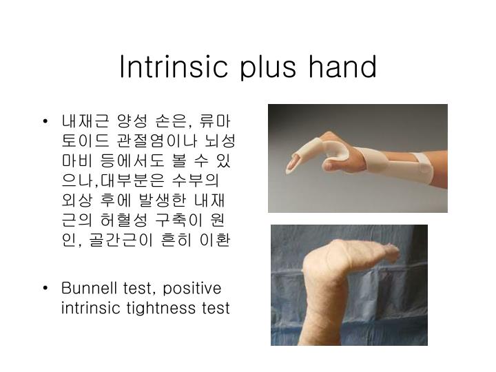 PPT - Affections of the elbow and hand PowerPoint Presentation - ID:796808