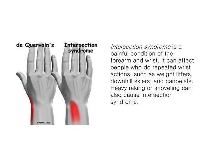 PPT - Affections of the elbow and hand PowerPoint Presentation - ID:796808