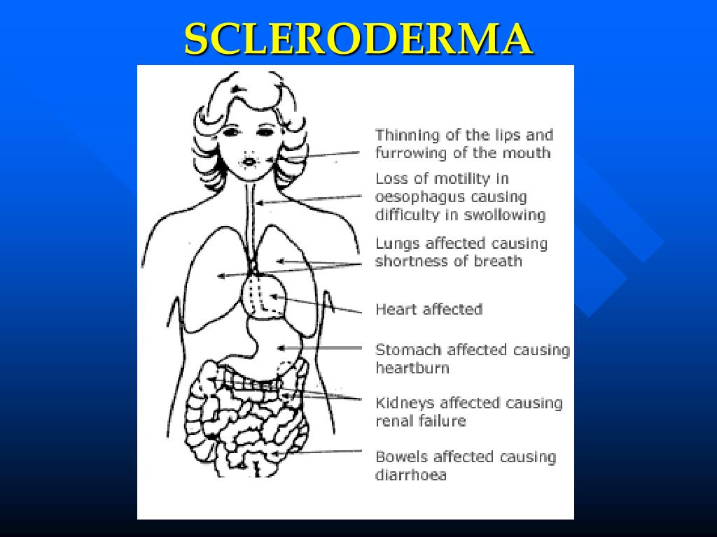 PPT - DERMATOLOGICAL MANIFESTATIONS OF SYSTEMIC DISEASE PowerPoint ...