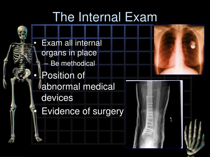 PPT - The Autopsy PowerPoint Presentation - ID:799535