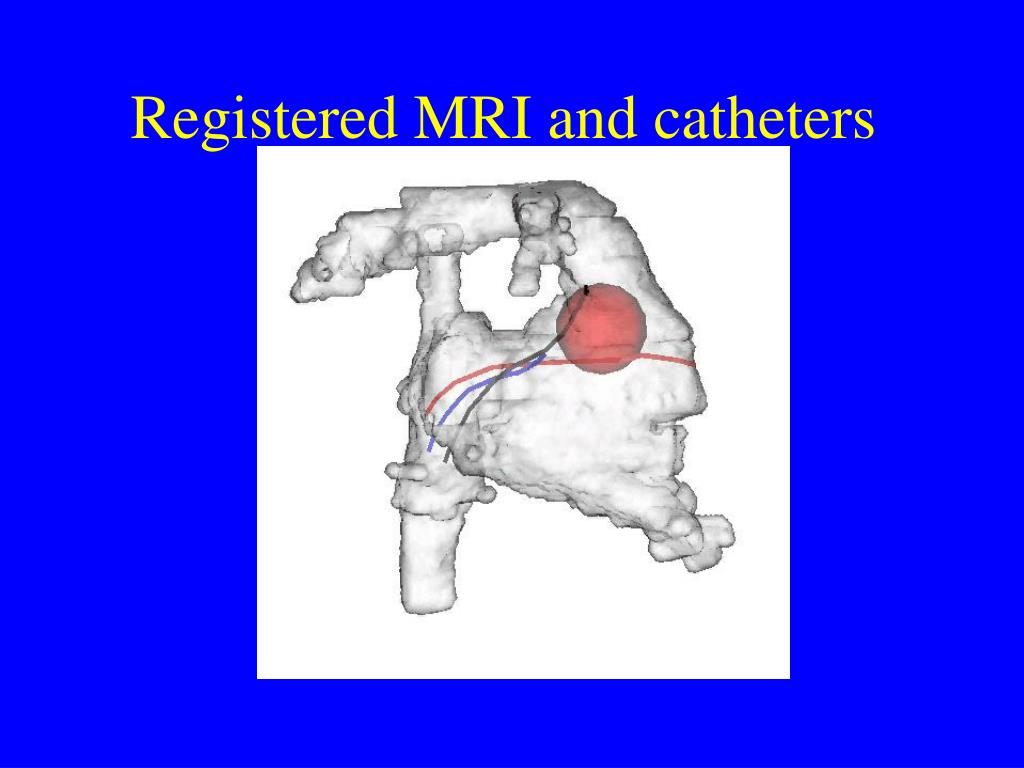 PPT - Image mapping, registration and atlases PowerPoint Presentation ...