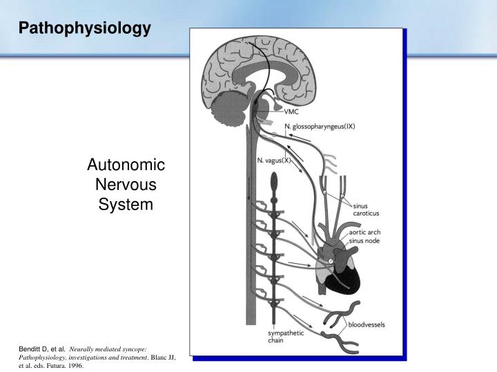 PPT - Syncope A Diagnostic and Treatment Strategy PowerPoint ...