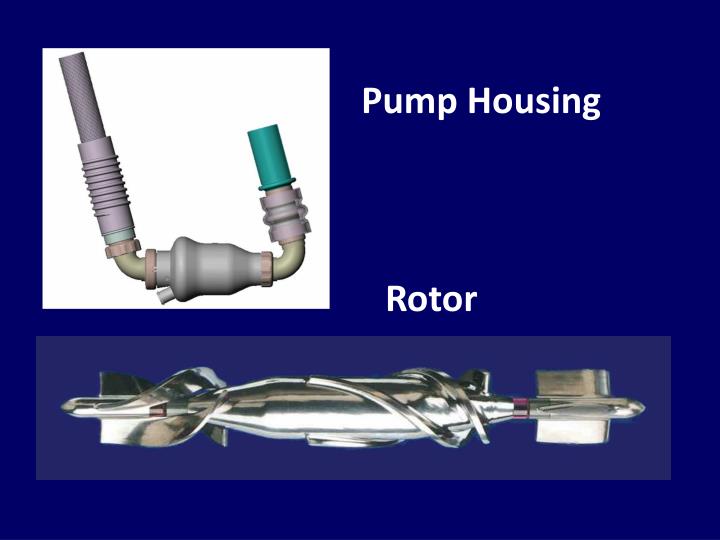 PPT - HeartMate II Left Ventricular Assist Device (LVAD) PowerPoint ...