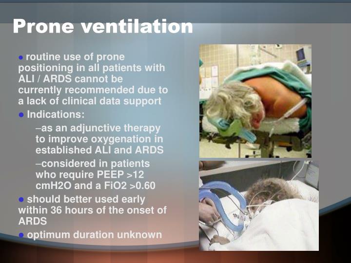 PPT - ARDS - Management PowerPoint Presentation - ID:802457