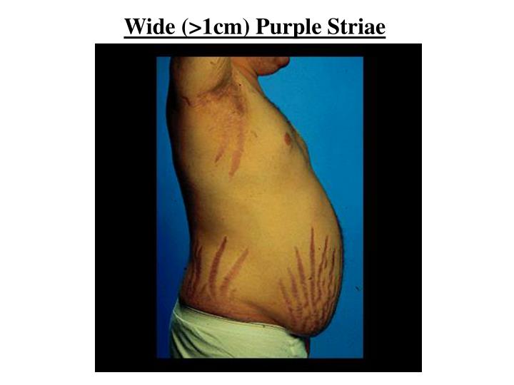 PPT - Diagnosis of Cushingâ s Syndrome PowerPoint Presentation - ID:804971