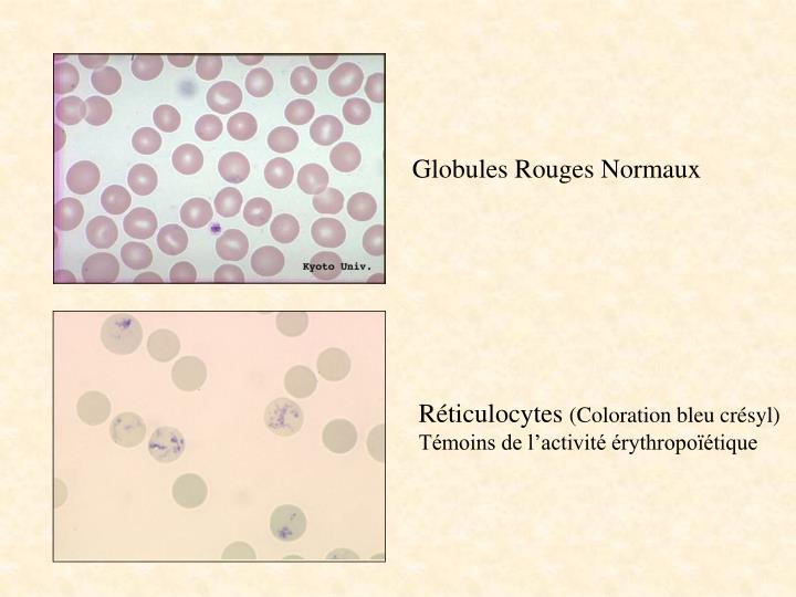 PPT - LES ANEMIES DE L’ENFANT PowerPoint Presentation - ID:805594