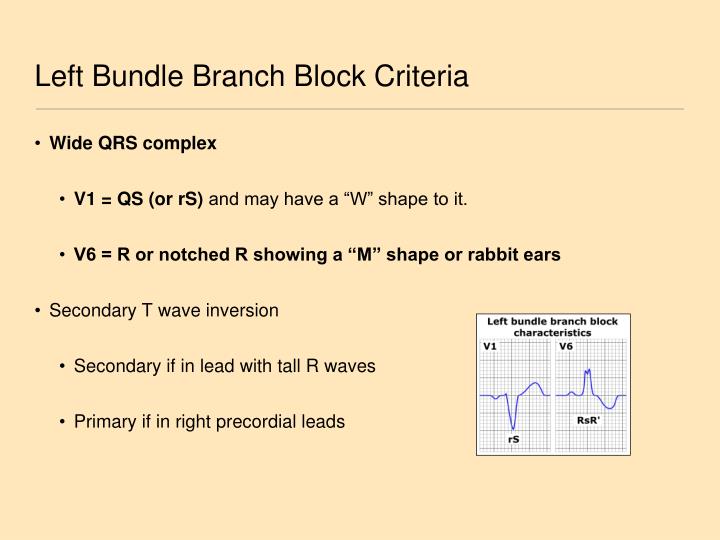PPT - Ventricular Conduction Disturbances PowerPoint Presentation - ID ...