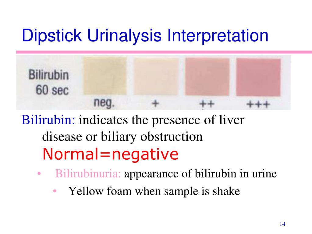 Urinalysis Dipstick Interpretation Diagnosis Urinalys - vrogue.co Urinalysis Dipstick Interpretation Diagnosis Urinalys - vrogue.co