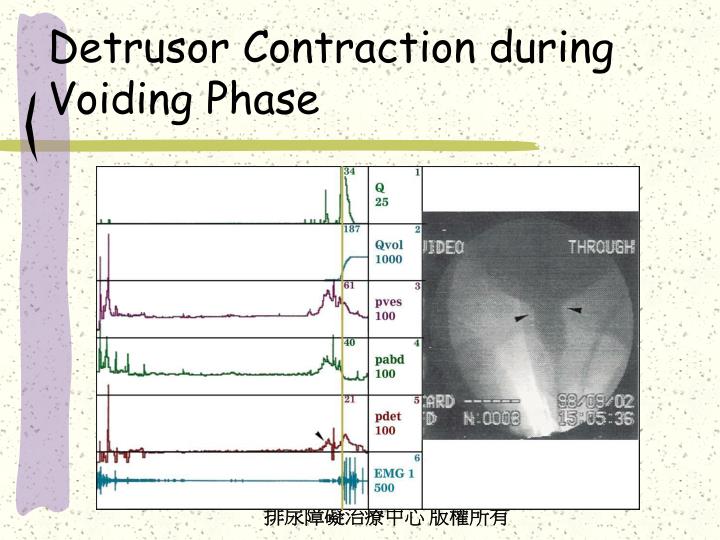 PPT - Physiology of Micturition PowerPoint Presentation - ID:813426