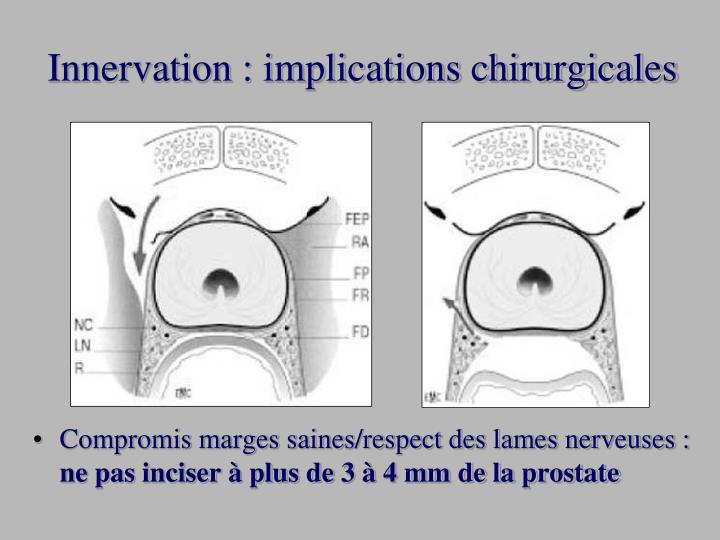 PPT - Radio-anatomie de la prostate PowerPoint Presentation - ID:814235