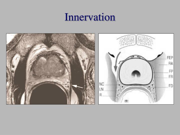 PPT - Radio-anatomie de la prostate PowerPoint Presentation - ID:814235