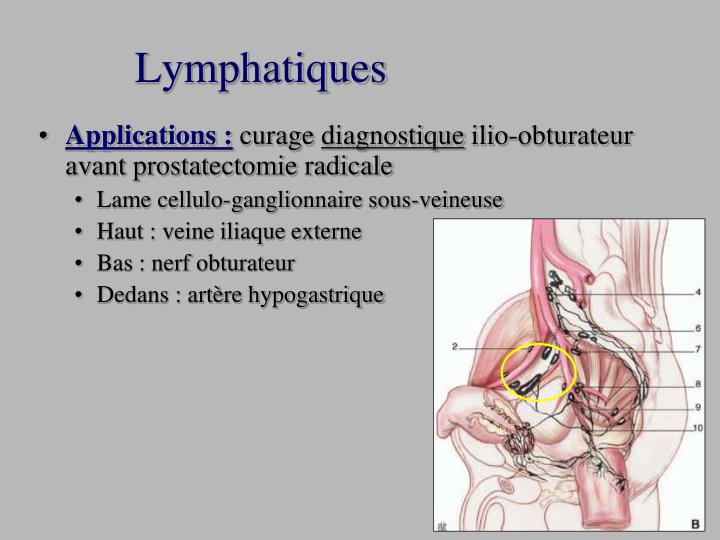 PPT - Radio-anatomie de la prostate PowerPoint Presentation - ID:814235
