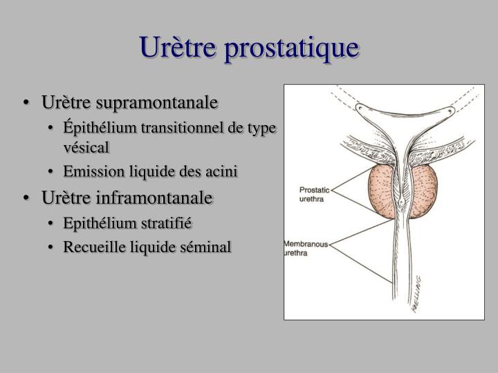 PPT - Radio-anatomie de la prostate PowerPoint Presentation - ID:814235