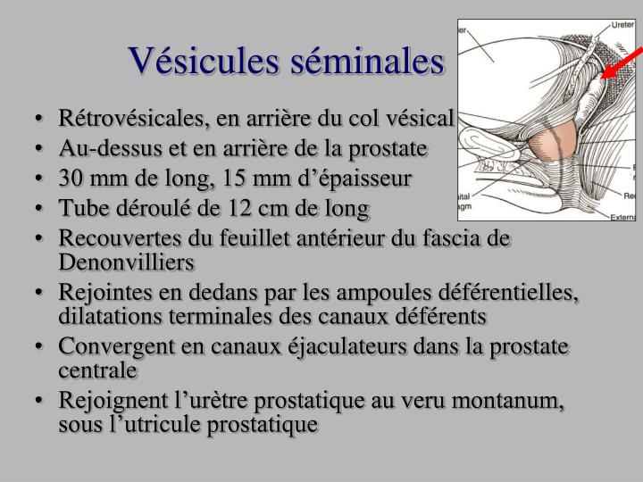 PPT - Radio-anatomie de la prostate PowerPoint Presentation - ID:814235