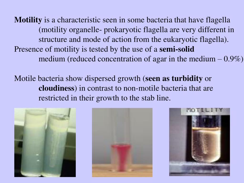 PPT - Introduction to Lab Ex. 16 Diagnostic Media Urea broth Sulfide ...