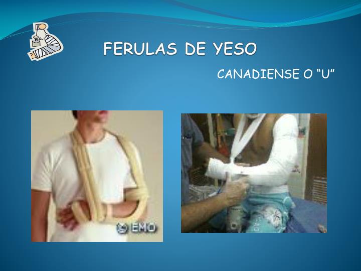 PPT - TRAUMATOLOGIA PowerPoint Presentation - ID:818387