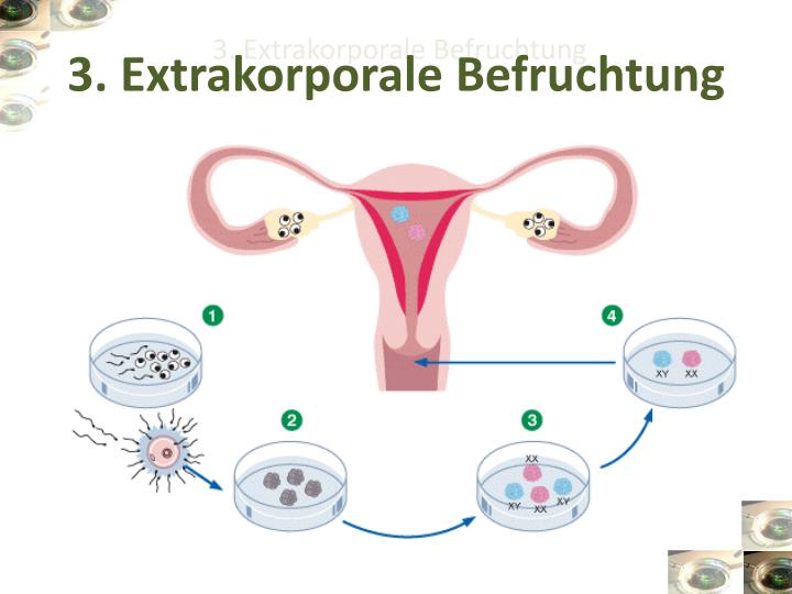 PPT - In-vitro-Fertilisation PowerPoint Presentation - ID:819677